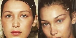 Fox Eyes in Lima for an Exotic New Look - Surgery in Peru